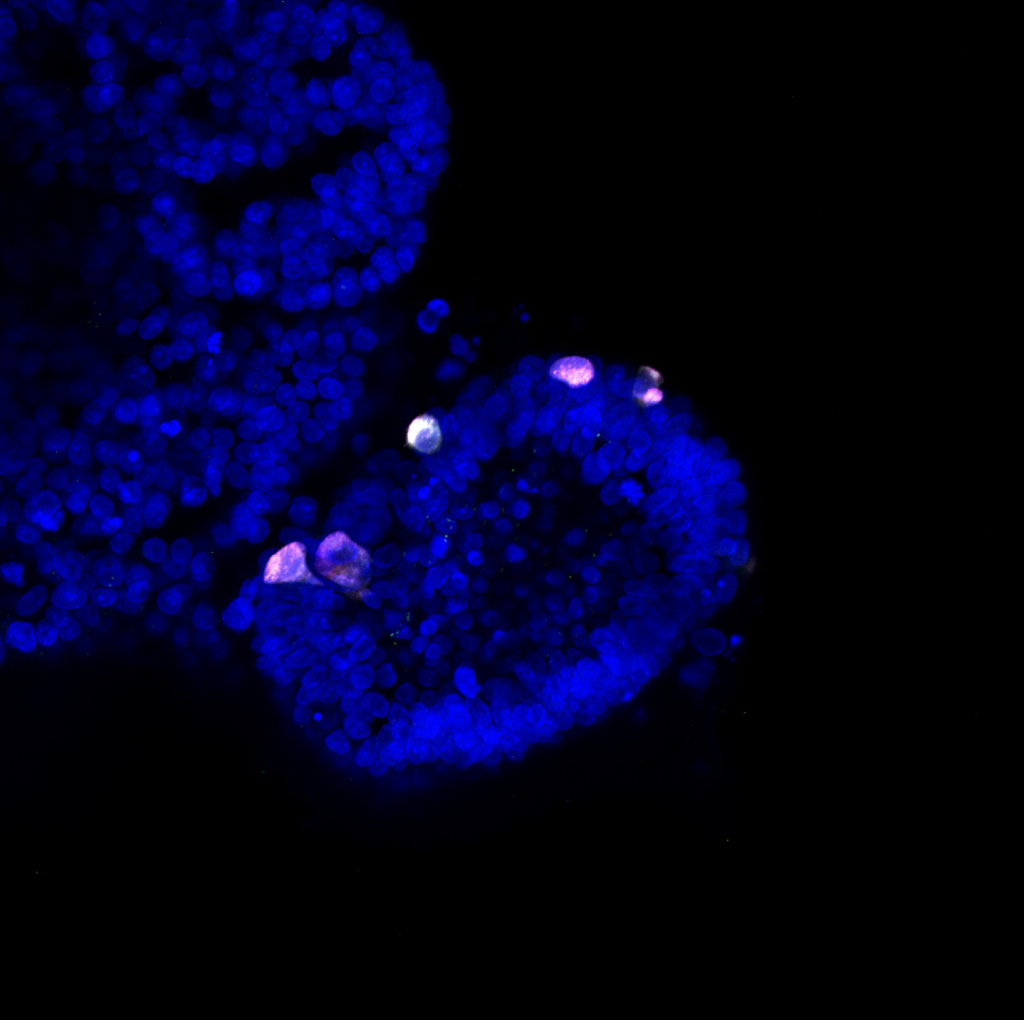 The first pancreatic organoid with all pancreatic cell types | Signals Blog