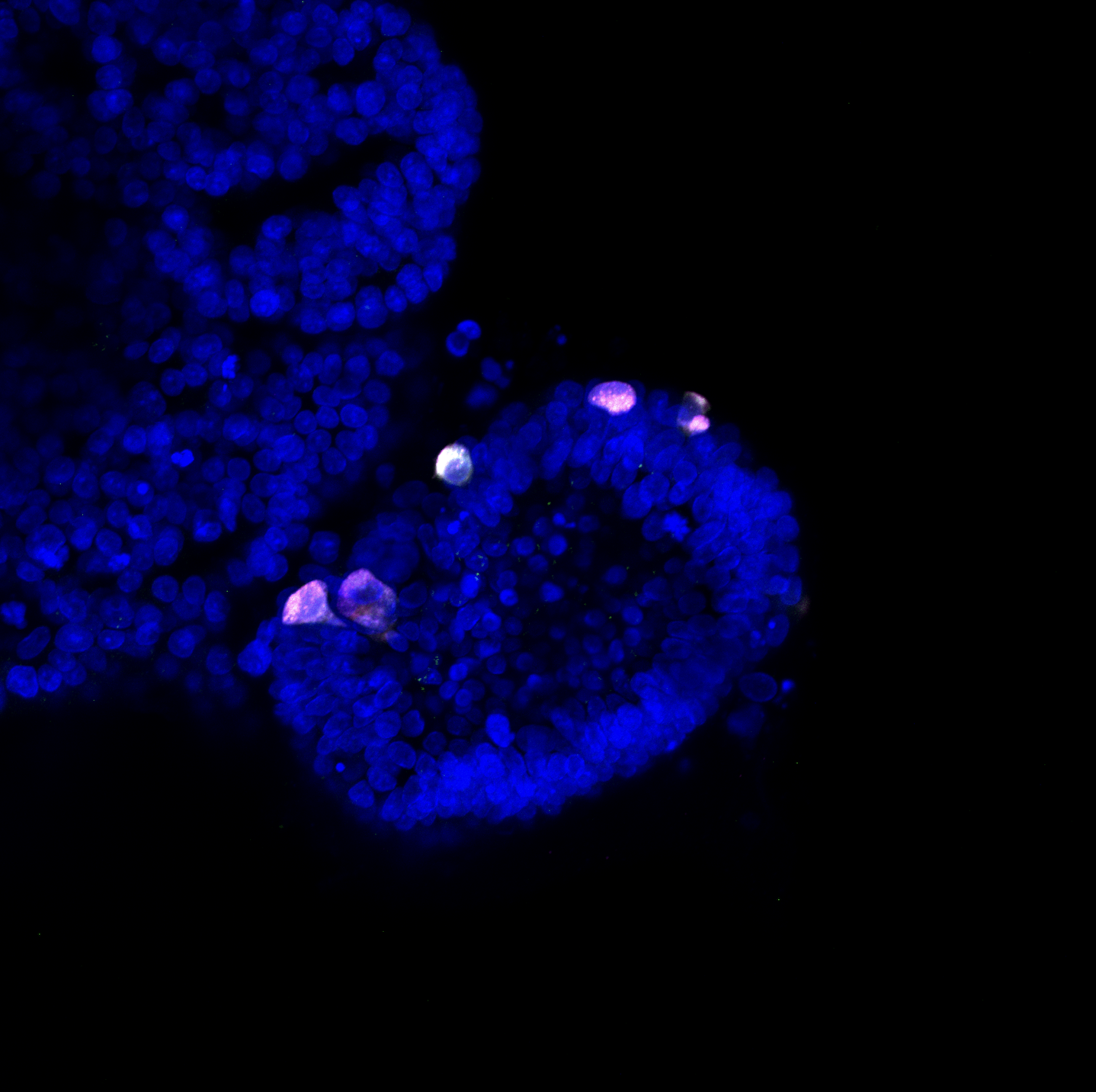 The first pancreatic organoid with all pancreatic cell types | Signals Blog